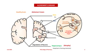 Alzheimer's disease recent advancements | PPSX
