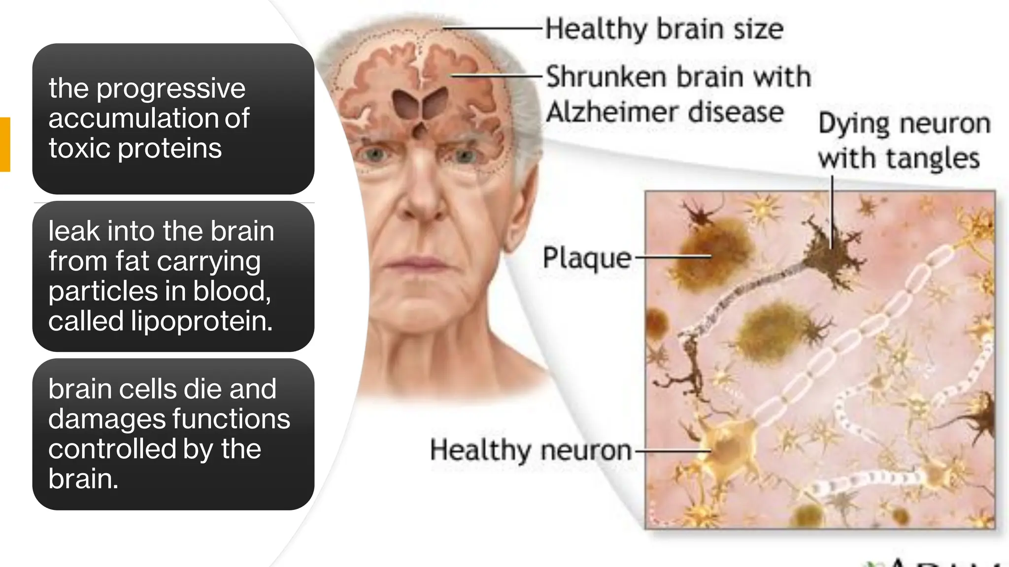 alzhimer disease introduction, treatment and symptoms | PPT