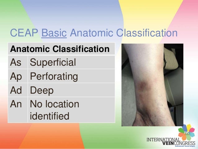 CEAP: The Key to the Initial Consultation