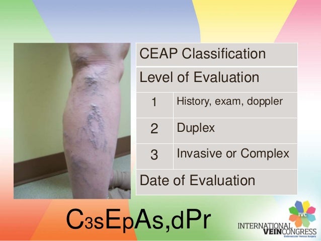 CEAP: The Key to the Initial Consultation
