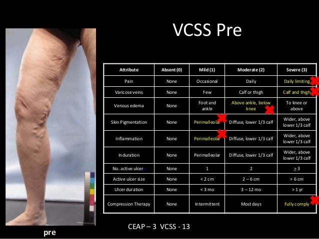 VCSS: Adds Sophistication