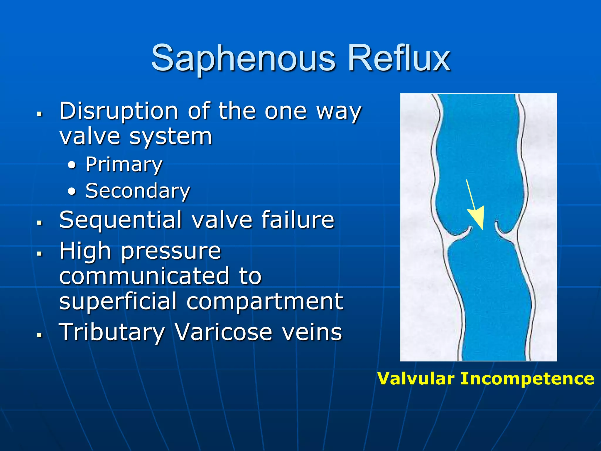The Great Saphenous Vein | PDF