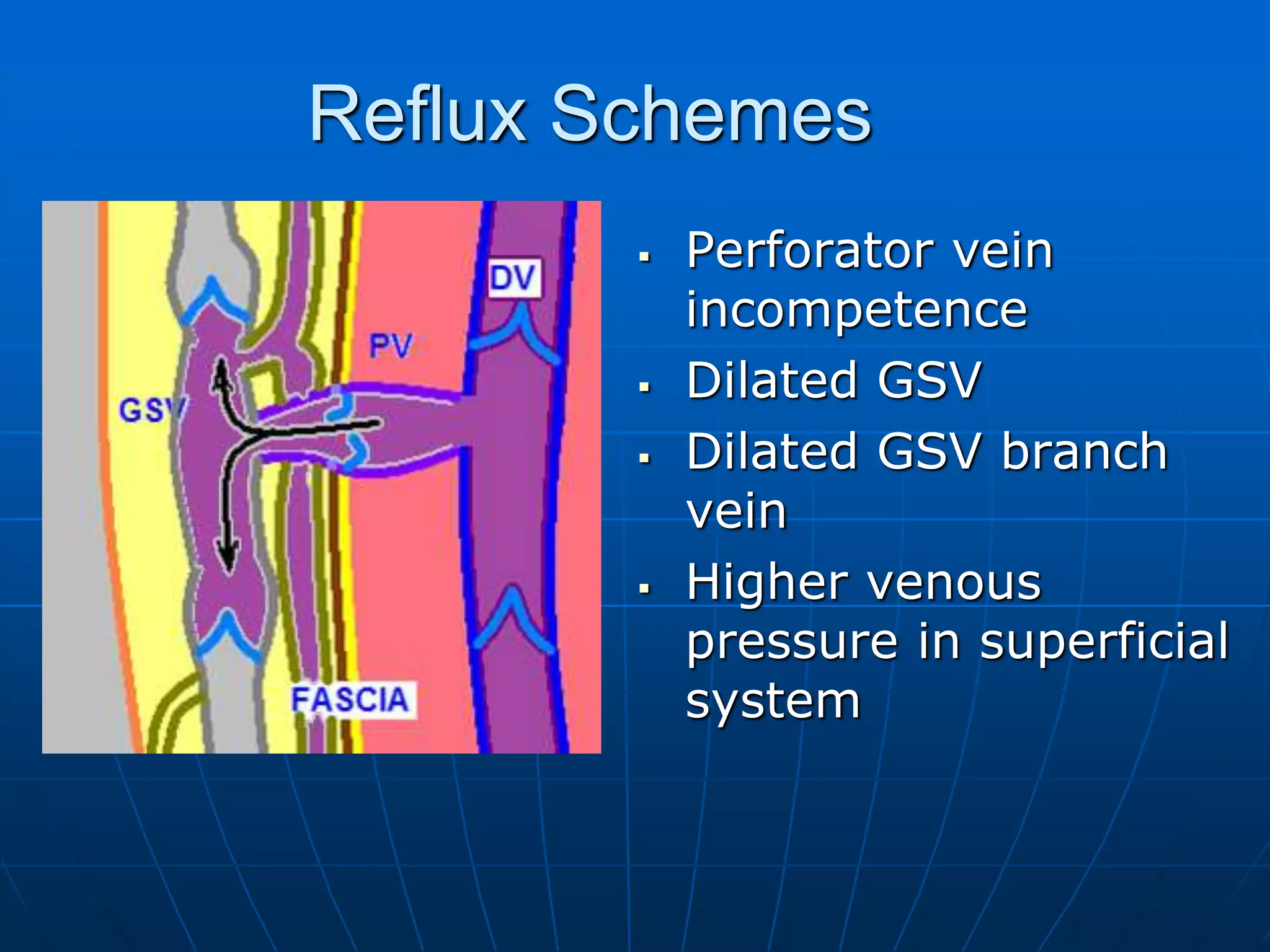 The Great Saphenous Vein | PDF
