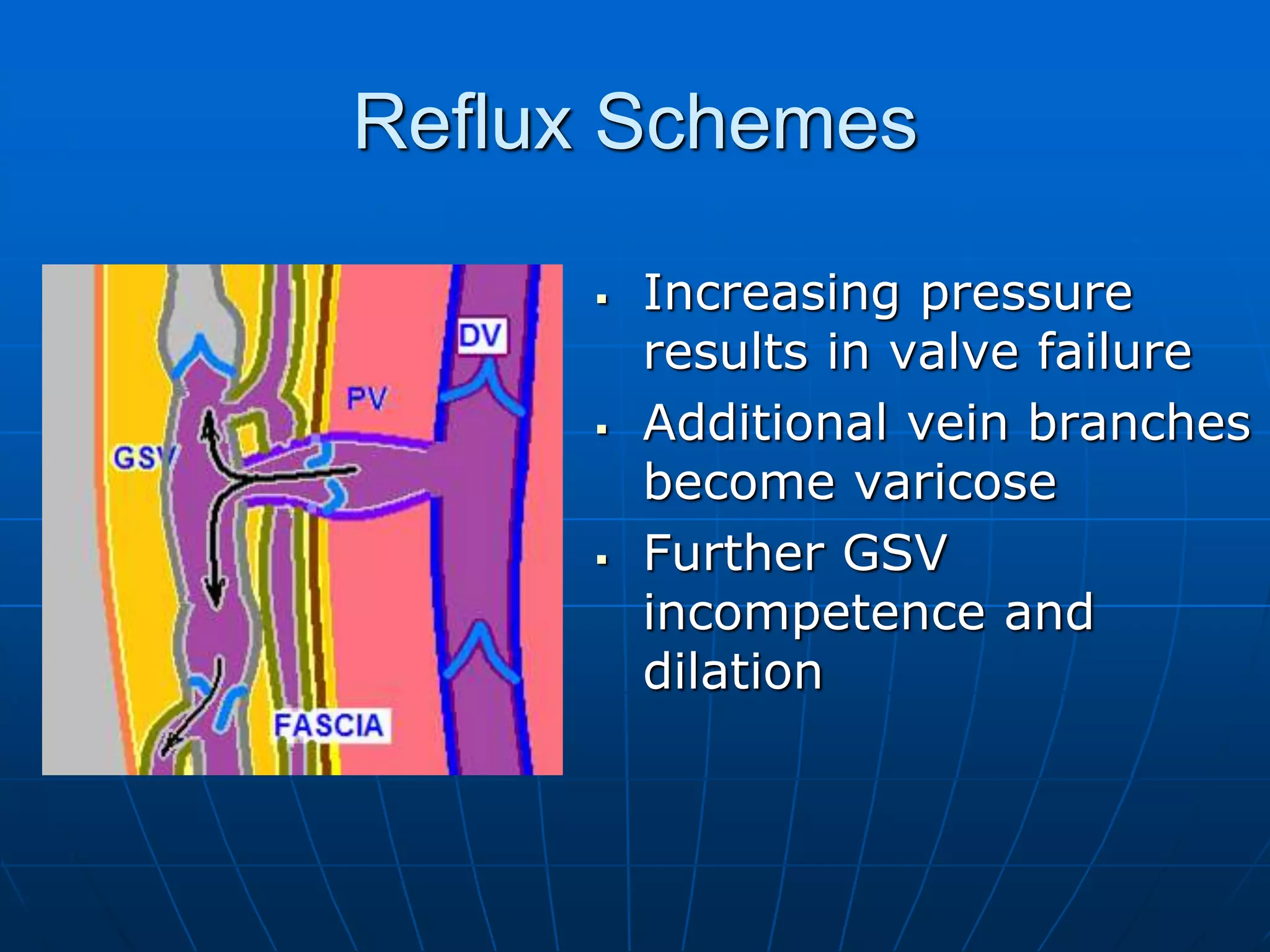 The Great Saphenous Vein | PDF