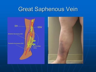 Saphenous Vein