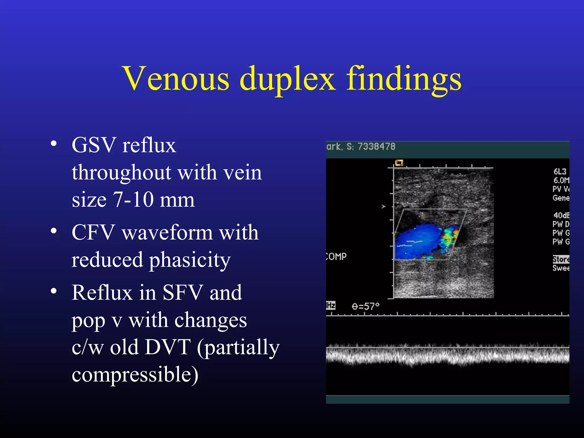 Who Needs More Testing Beyond Venous Duplex? | PPT