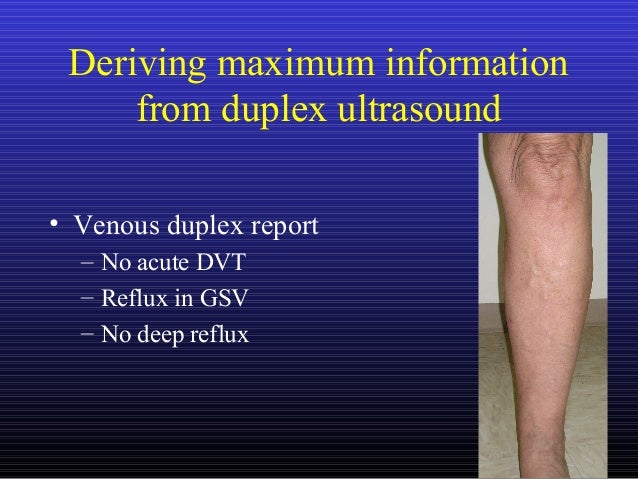 Who Needs More Testing Beyond Venous Duplex?