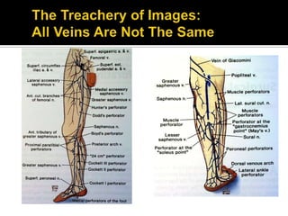 SSV: Anatomy & Pathophysiology | PDF
