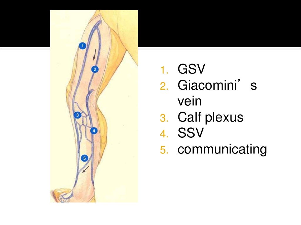 SSV: Anatomy & Pathophysiology