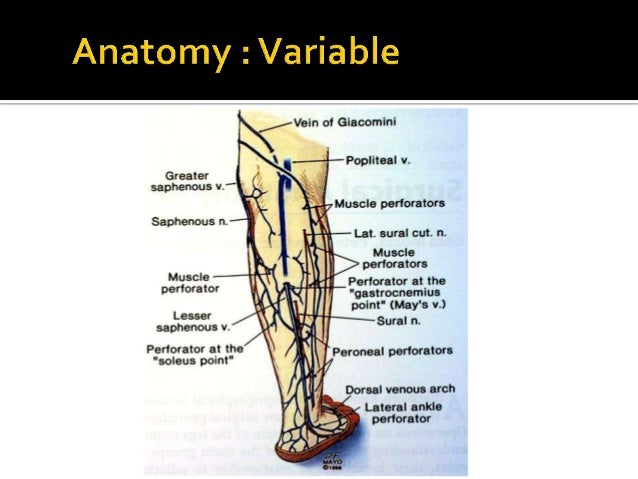 SSV: Anatomy & Pathophysiology