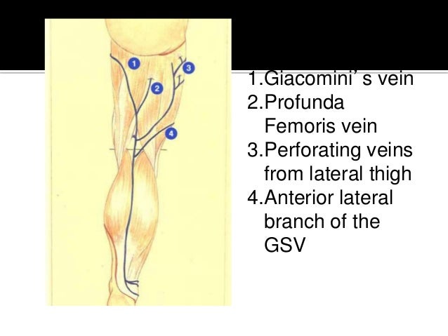 SSV: Anatomy & Pathophysiology