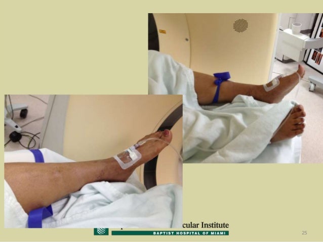 When is MR Venography Useful? What makes it so Operator Dependent?