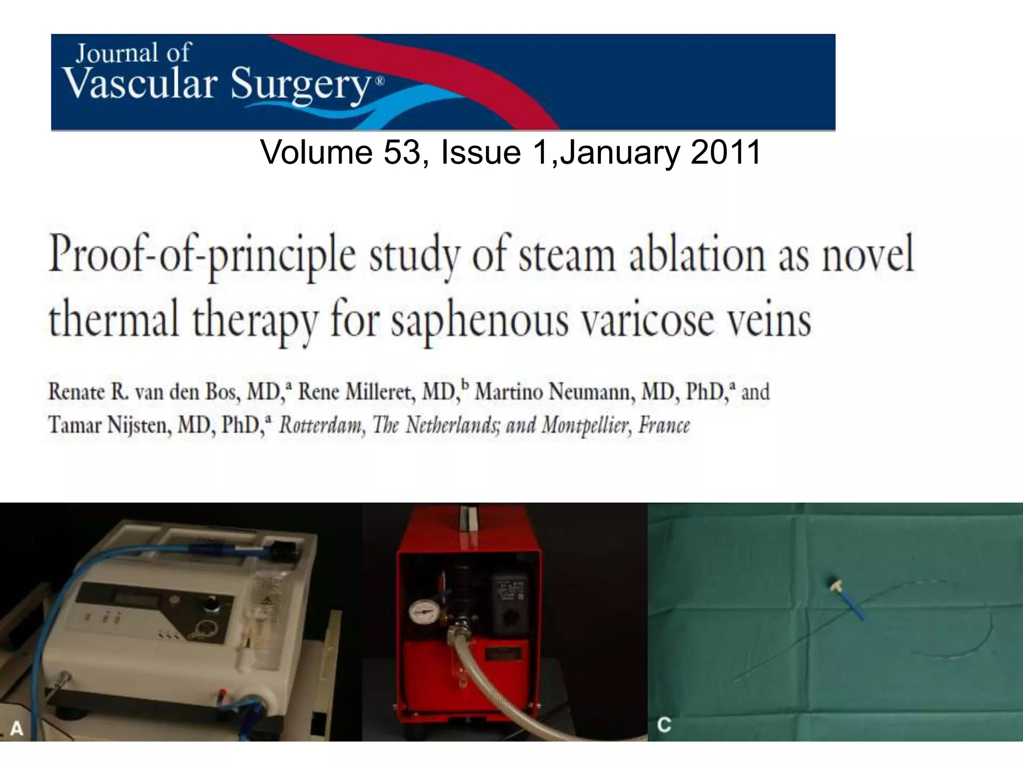 Small Saphenous Thermal Ablation | PDF