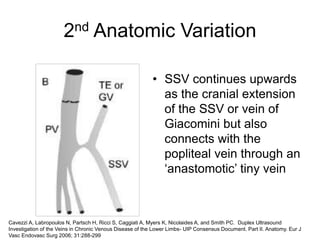 Small Saphenous Thermal Ablation | PDF