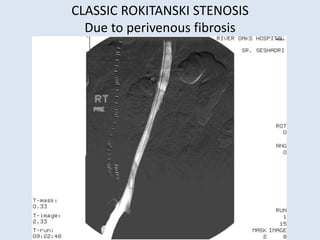 Pitfalls of IVUS Imaging | PPT