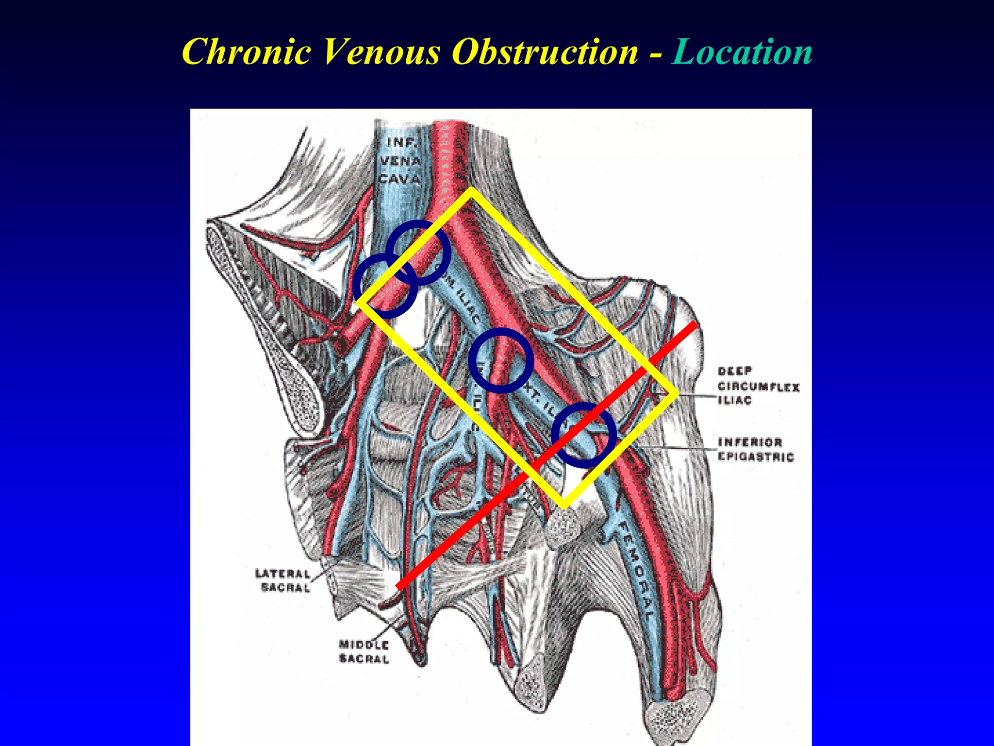 Deep Vein Pathophysiology: Reflux & Obstruction | PDF
