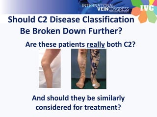 Should C2 Disease Classification Be Broken Down Further? Who Progresses ...