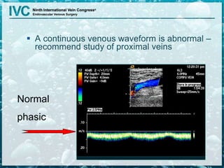 Detecting Deep Venous Disease with Duplex Ultrasound | PPT