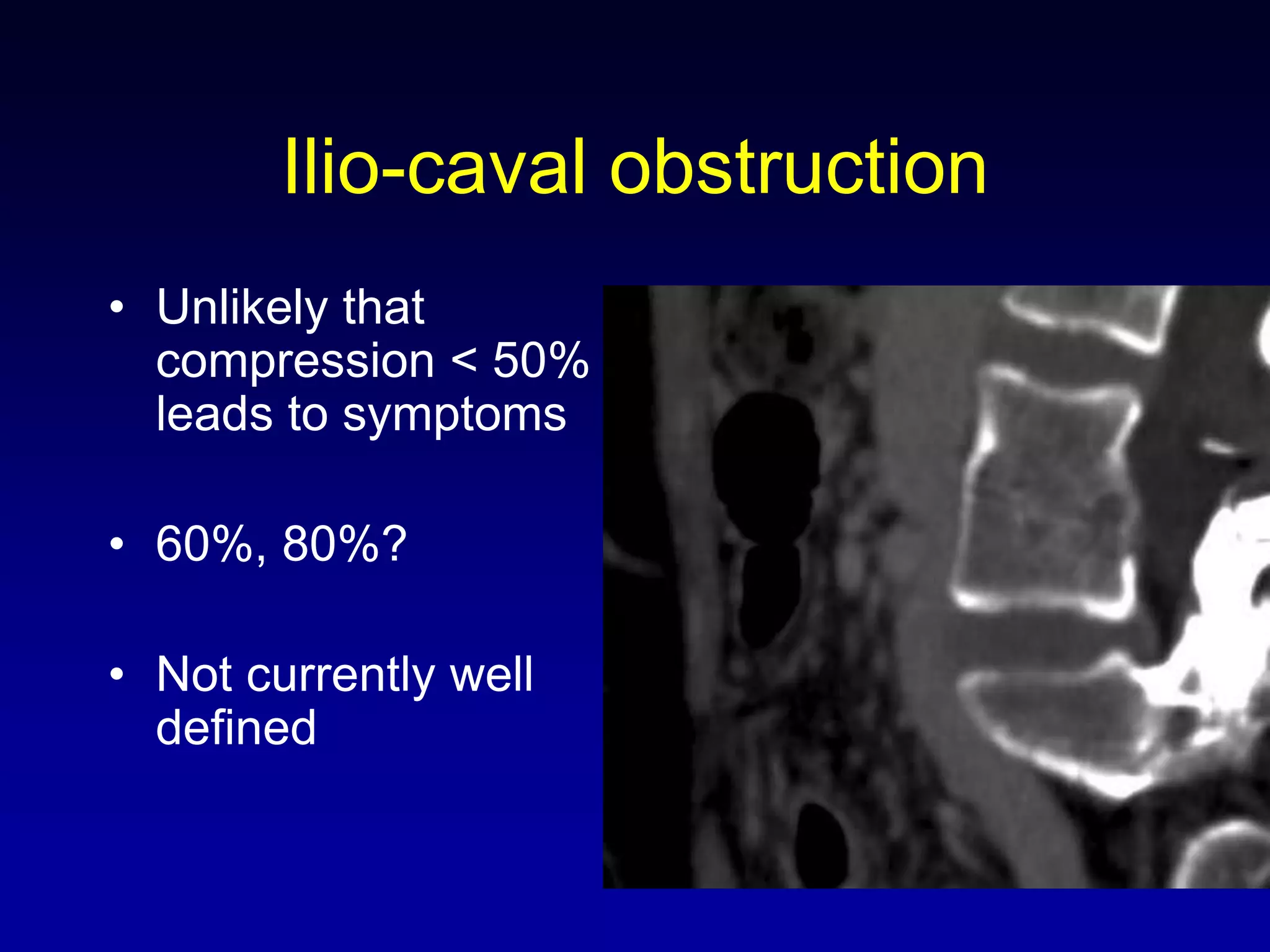 Diagnosis of Llio-caval Venous Obstruction: Causes of Venous ...