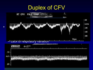 Diagnosis of Llio-caval Venous Obstruction: Causes of Venous ...