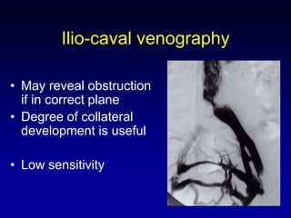 Diagnosis of Llio-caval Venous Obstruction: Causes of Venous ...