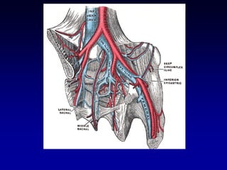 Diagnosis of Llio-caval Venous Obstruction: Causes of Venous ...