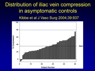 Diagnosis of Llio-caval Venous Obstruction: Causes of Venous ...