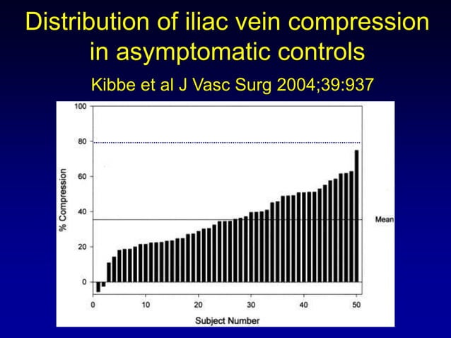 Diagnosis of Llio-caval Venous Obstruction: Causes of Venous ...
