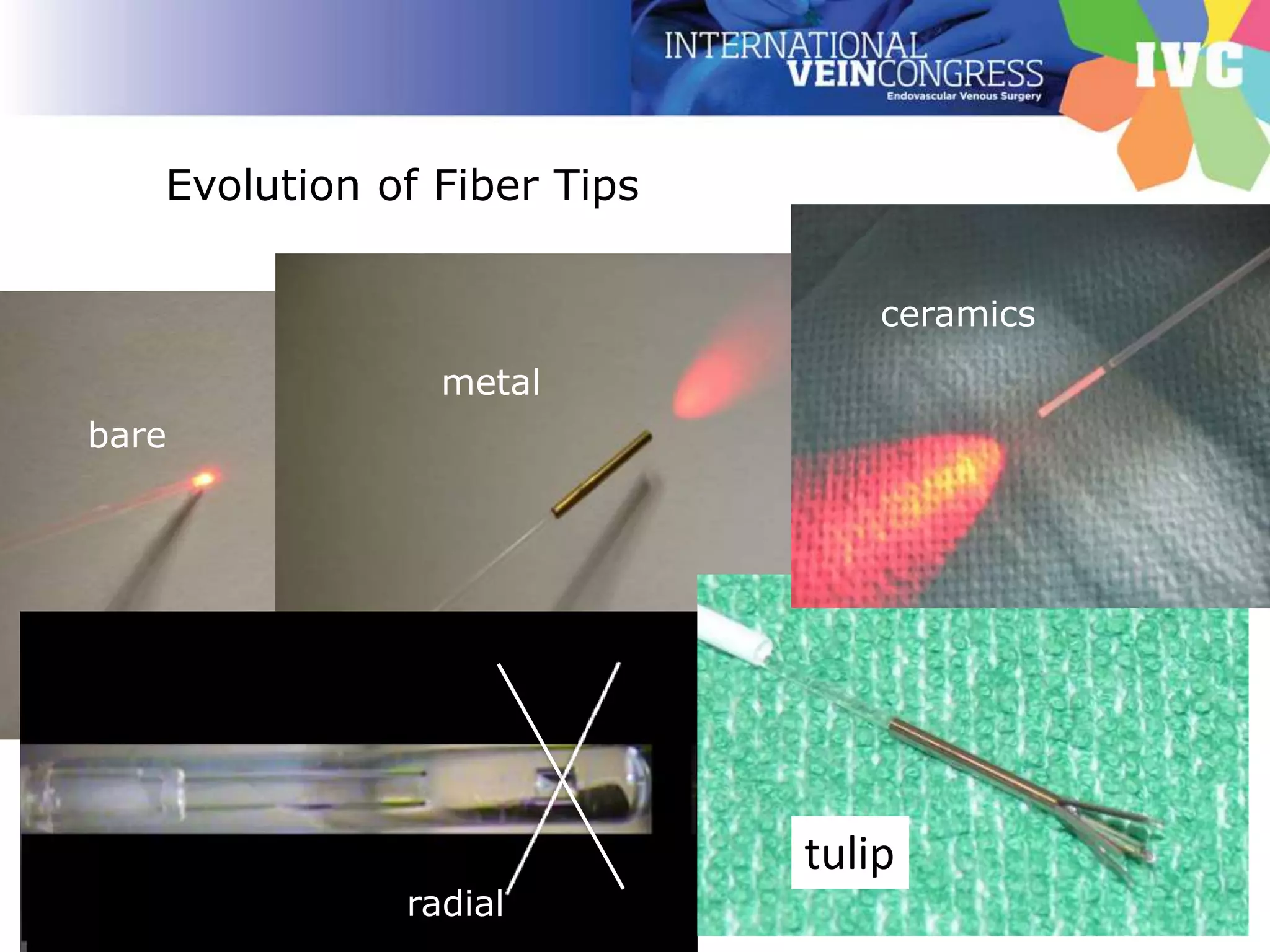 Future of Laser Ablation: New Wavelength or Fiber Tips? | PPTX