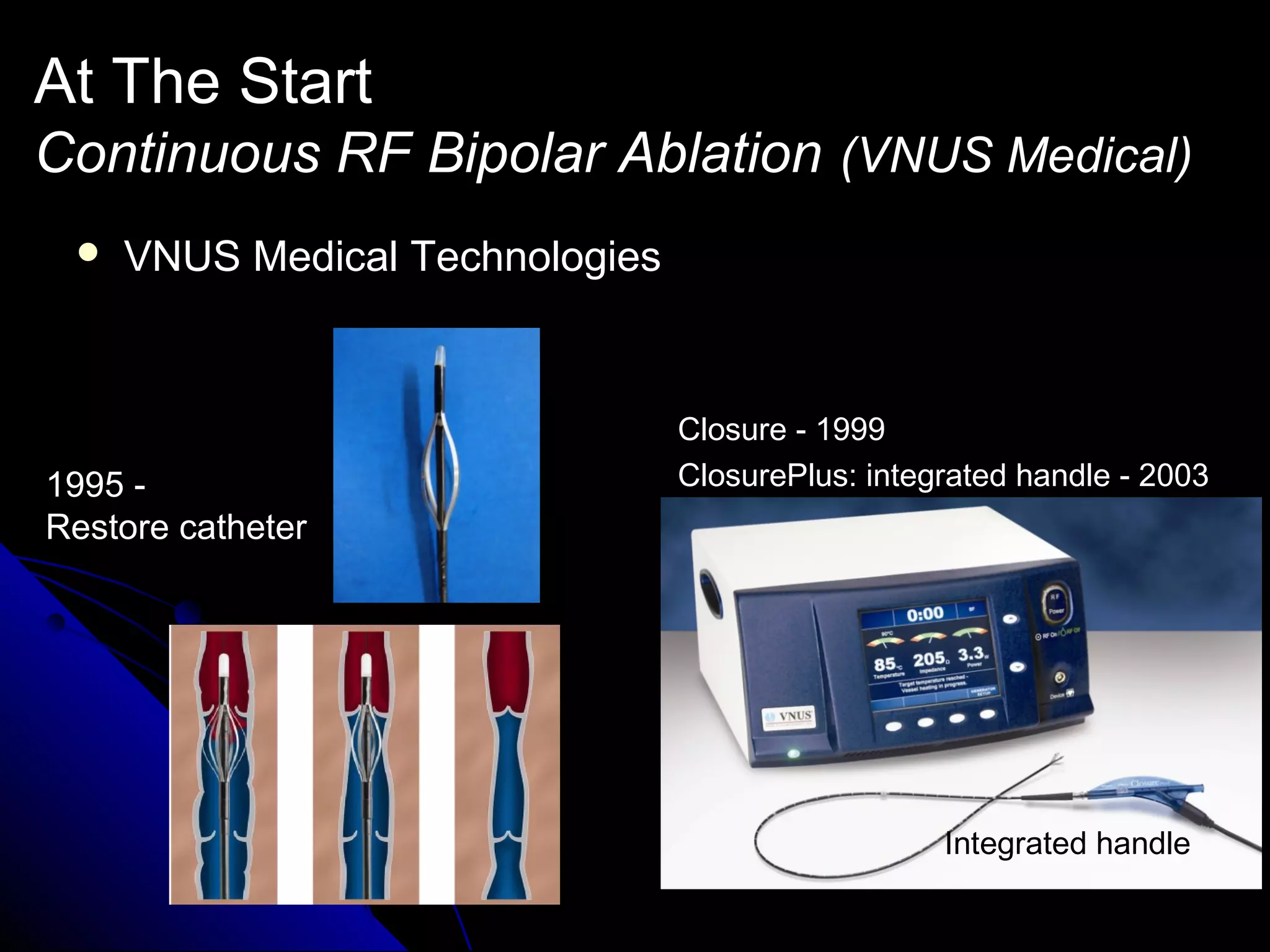 Future of RF Ablation: Continuous or Segmental? | PPT