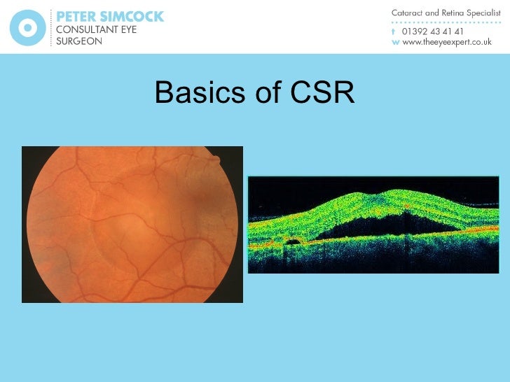 A macular pathology and oct update for optometrists