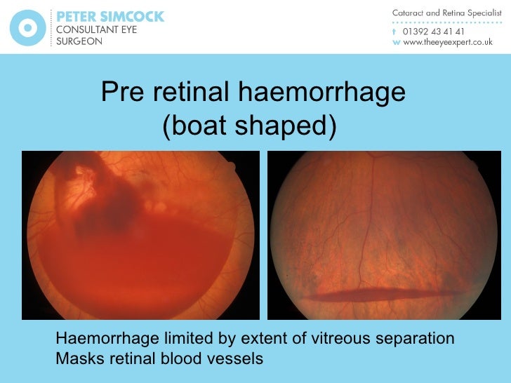 A macular pathology and oct update for optometrists