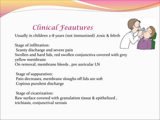 diseases of the conjuntiva | PPT