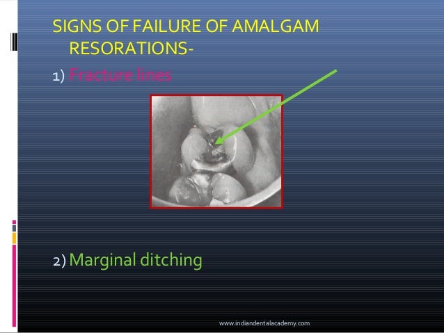 Amalgam/prosthodontic courses