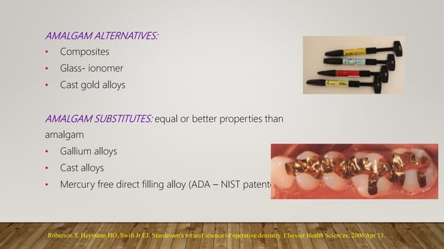 Amalgam | PPTX | Dental Health | Diseases and Conditions