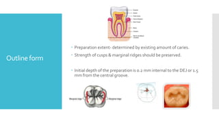 Dental Amalgam | PPT