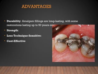 amalgam filling material in conservative dentistry | PPT