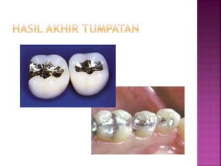 Amalgam | PPTX