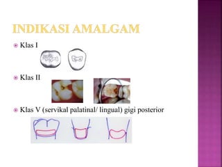 Amalgam | PPTX