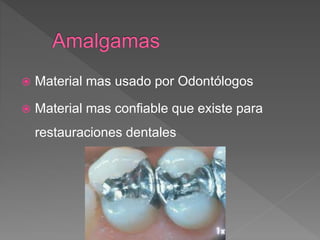 AMALGAMA DENTAL.pptx