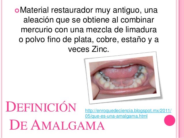 Qu Es Una Amalgama Dental Odontotecks AUXILIAR DE FARMACIA