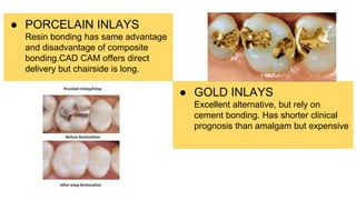 Amalgam alternatives | PPTX | Oral care | Personal Care