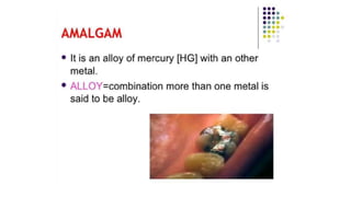 Amalgam alternatives | PPTX | Oral care | Personal Care