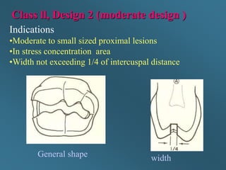 Amalgam cavity design | PPT