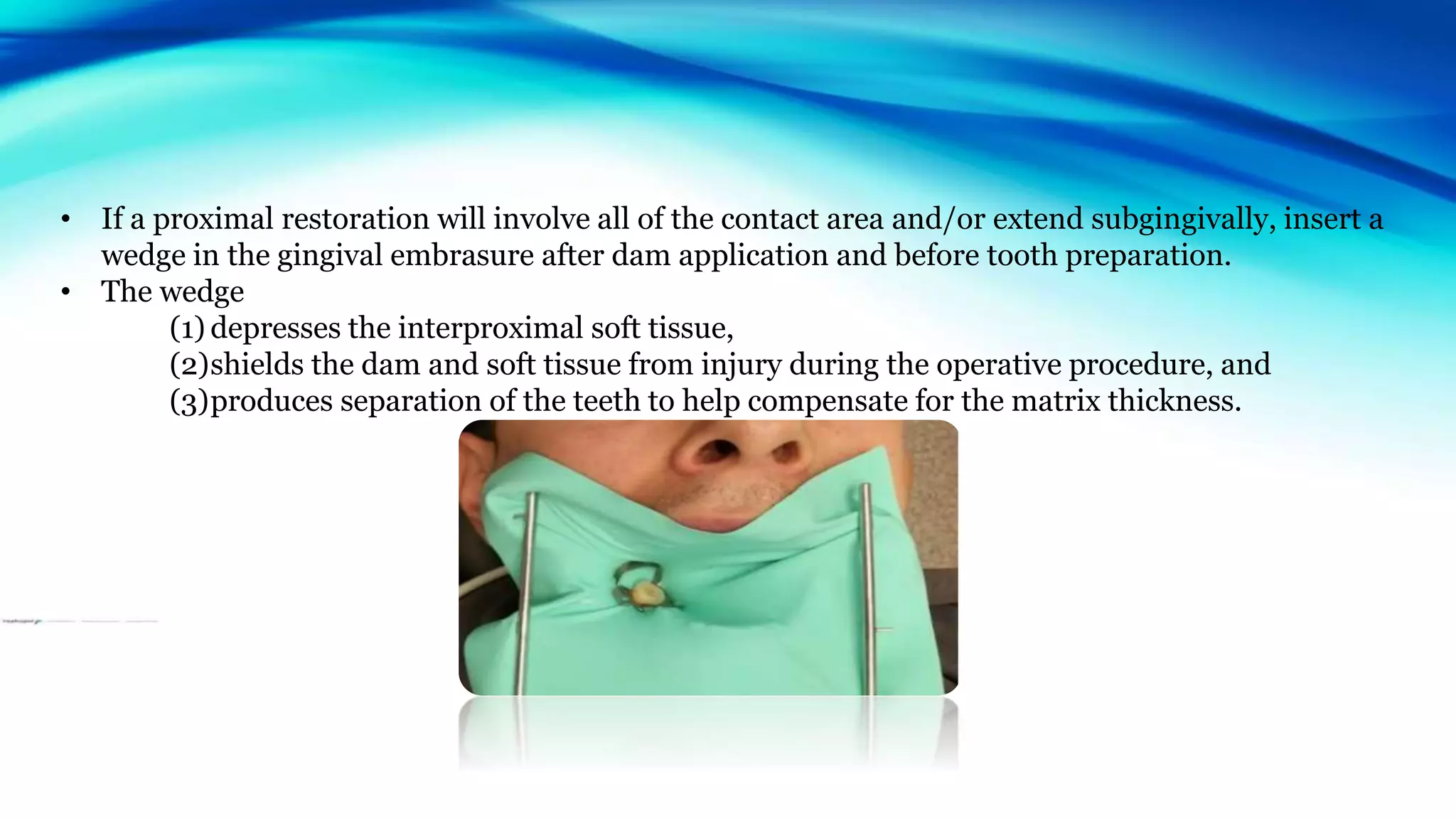 AMALGAM CAVITY PREPARATION | PPTX