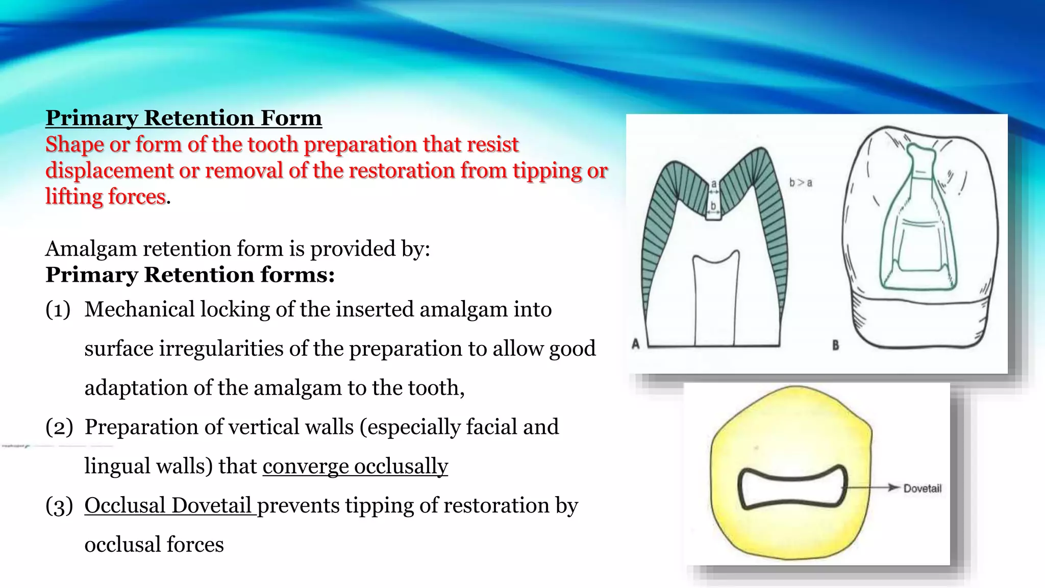 AMALGAM CAVITY PREPARATION | PPTX