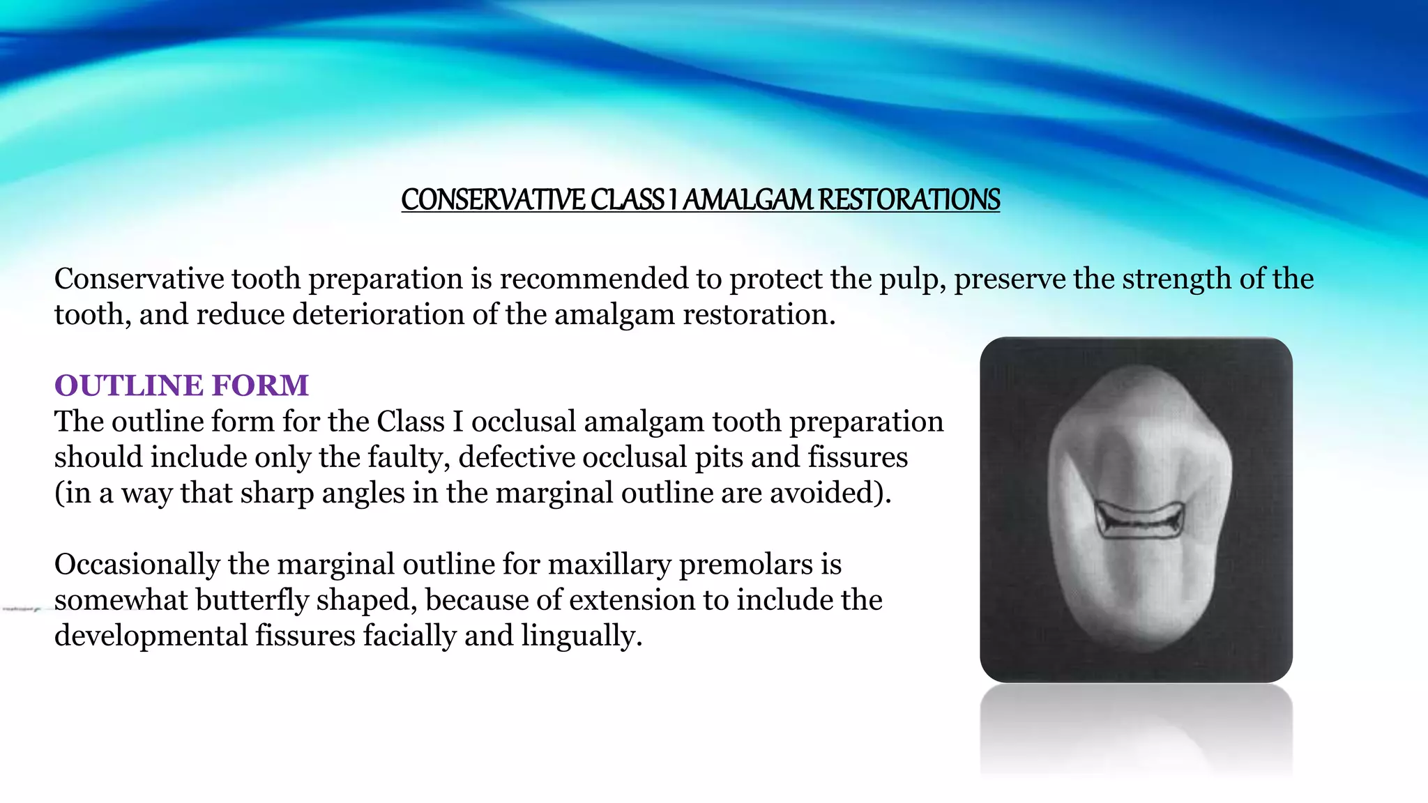 AMALGAM CAVITY PREPARATION | PPTX