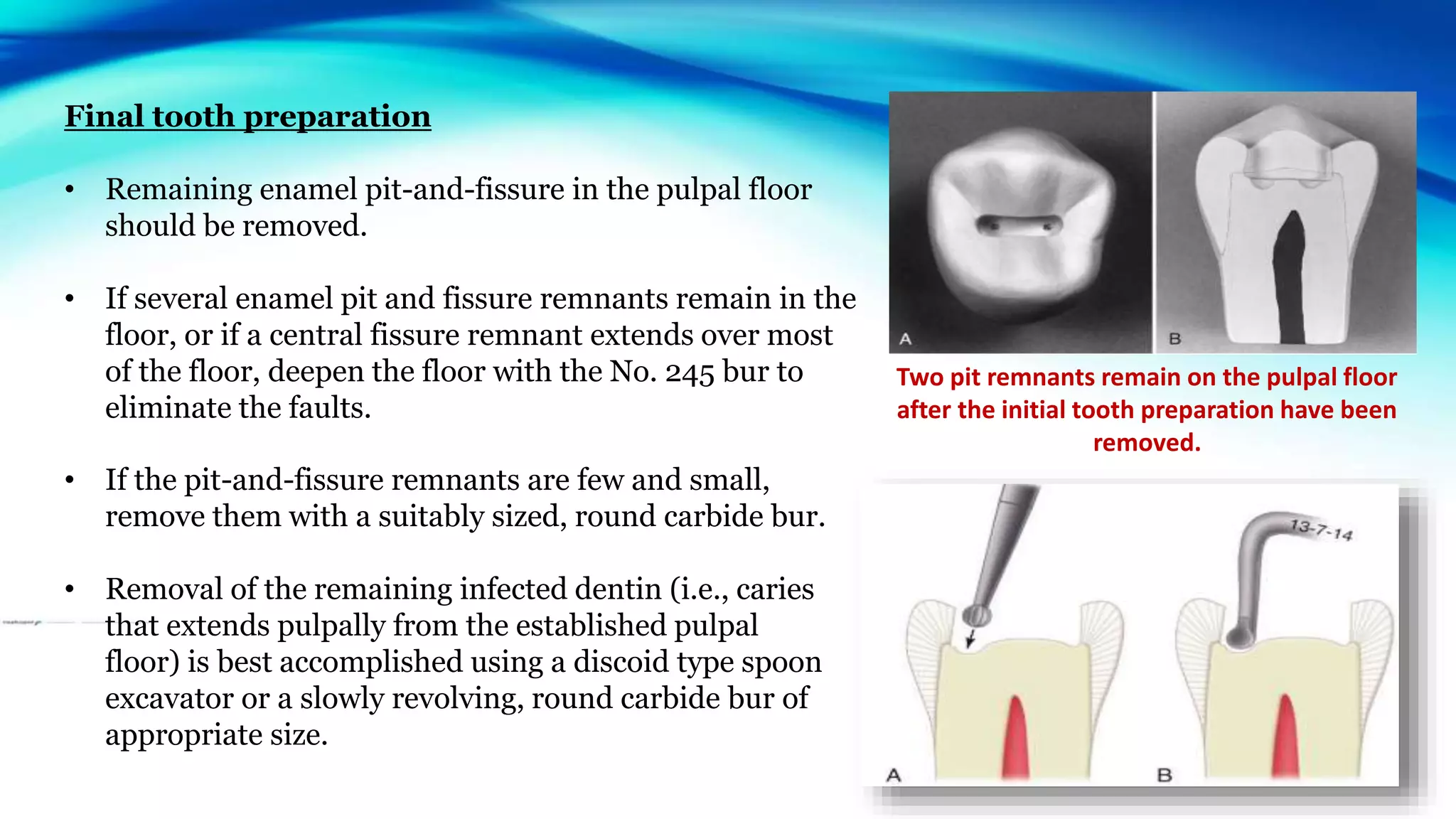 AMALGAM CAVITY PREPARATION | PPTX