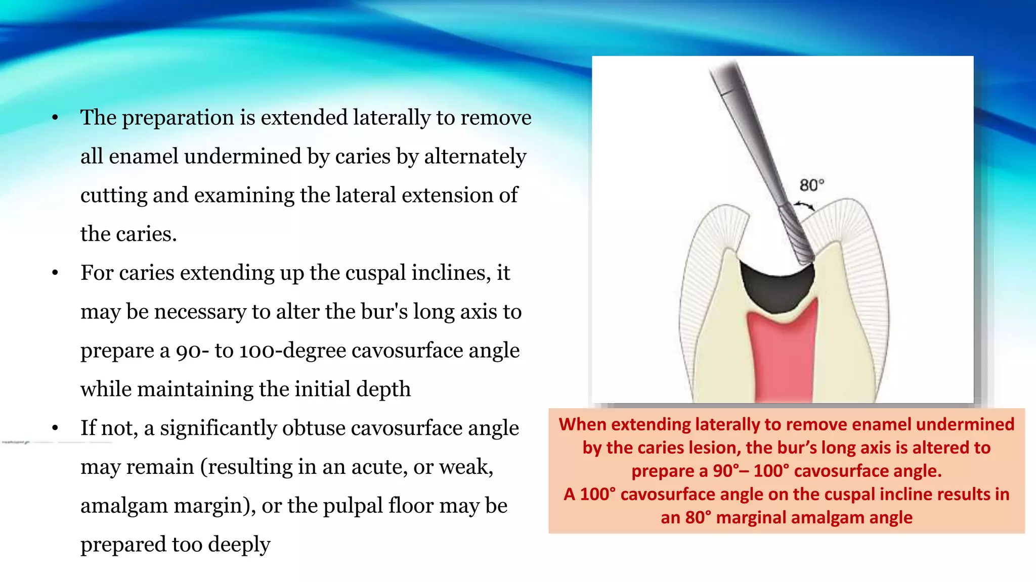 AMALGAM CAVITY PREPARATION | PPTX