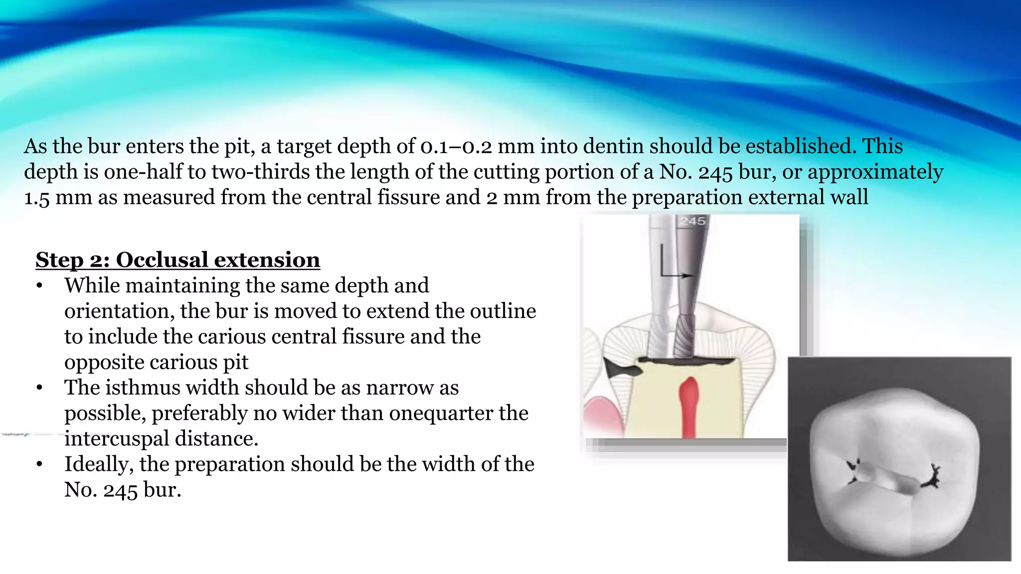 AMALGAM CAVITY PREPARATION | PPTX